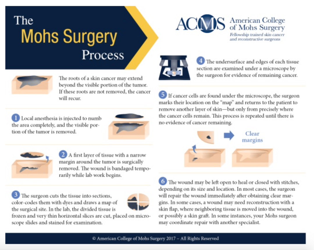 Mohs Surgery | Dr. Mark Abdelmalek